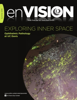 UC Davis Eye Center